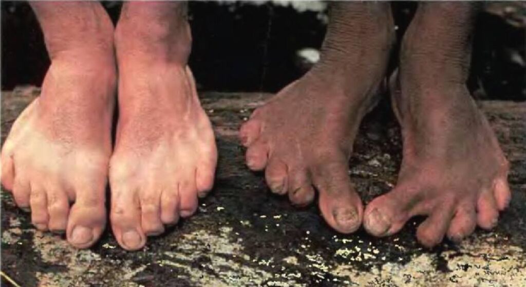 With Spears from all Sides - Information for the Future of Arcata